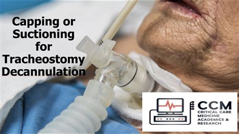 Decannulation Technique Nejm Trial Redecap Youtube