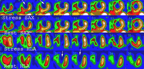The Defect Reversibility Non Reversible Or “fixed” Defects Selected