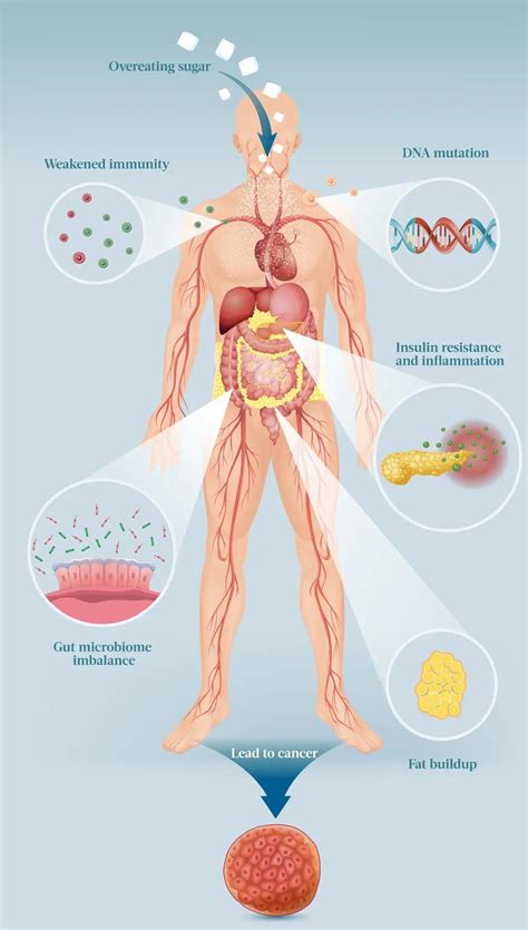How Sugar Fuels Cancer In The Body Zerohedge