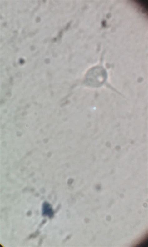 111 Questions With Answers In Spirulina Science Topic