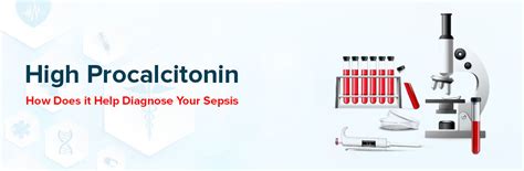 High Procalcitonin How Does It Help Diagnose Your Sepsis Ganesh