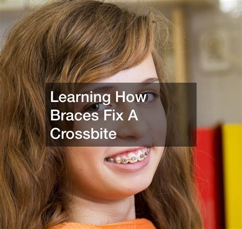 Learning How Braces Fix A Crossbite Nutrition Magazine