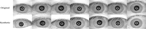 Synthetic Iris Image On Casia Irisv40 Interval Download Scientific Diagram