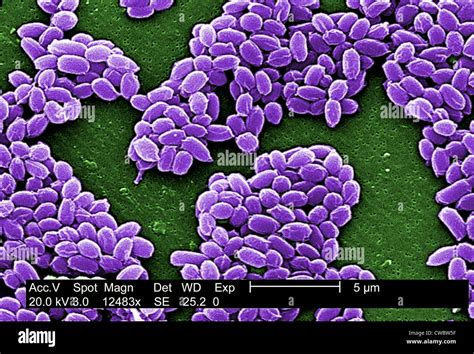 What Are Anthrax Spores At Savannah Mccarthy Blog