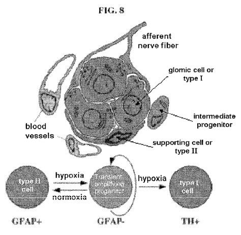 Carotidbody 千图网