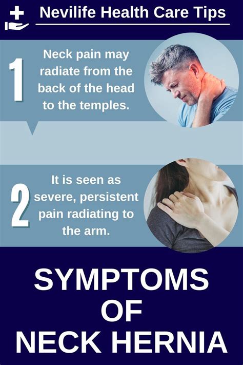 Symtoms Of Neck Hernia Artofit