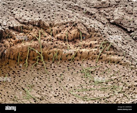 Dentin Tooth Tissue Coloured Scanning Electron Micrograph Sem Of