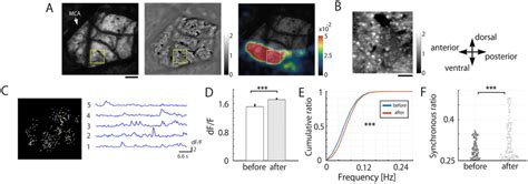 Two Photon Calcium Imaging Of Ic Spontaneous Neuronal Activities In The