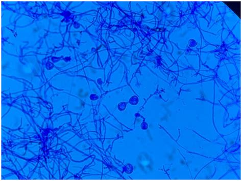 Isolation Of Filamentous Basidiomycetes From Respiratory Samples In A