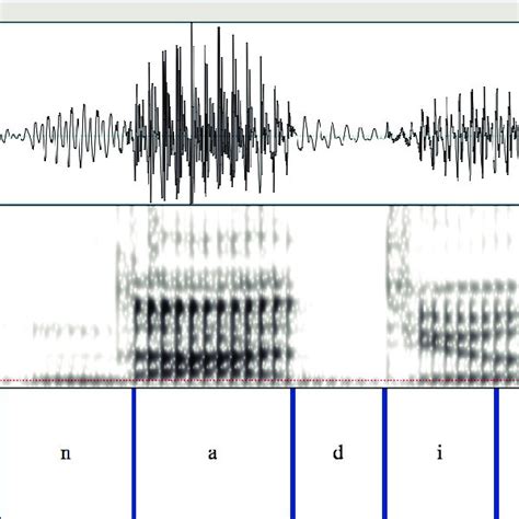 Spectrogram Of Radio As Produced By A Male Seoul Speaker In His 20s