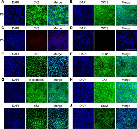 Marker Expression Of Mouse Cripscs The Prostate Epithelial Cells