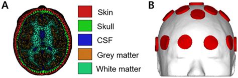 the model used for fem calculation a mri based realistic finite