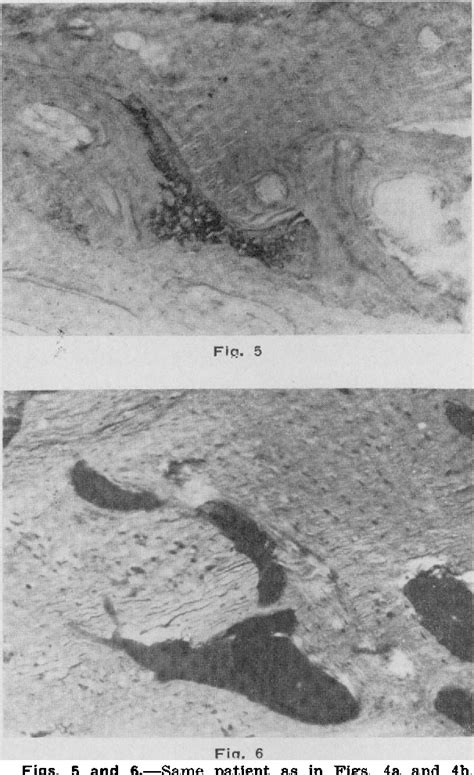 Figure 1 From Pathogenesis Of Osteogenesis Imperfecta Semantic Scholar