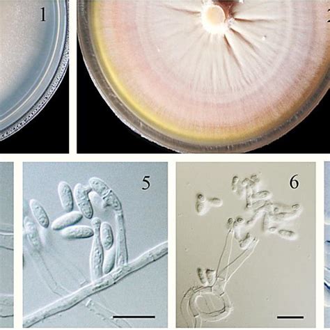 Plectosphaerella Cucumerina 1 2 Colonies On Pda And Mea After 14 D At