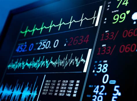 Premature Ventricular Contractions Pvcs Causes Symptoms Diagnosis