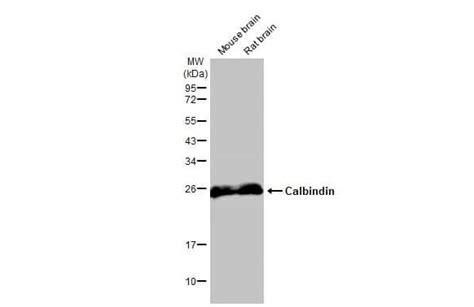 Calbindin D 28k Products