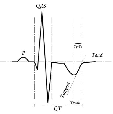 Schematic Presentation Of The Measurement Of The Tp Te Interval In The