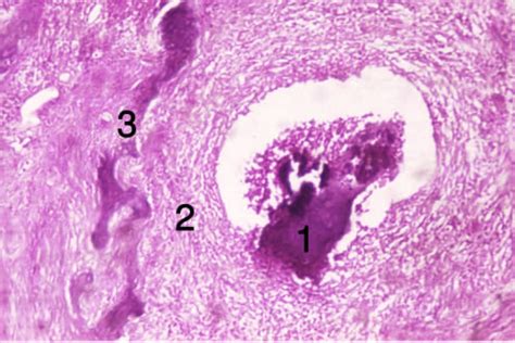 Tissue Section From The Alveolar Socket Of The Third Group First