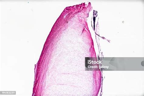 Histology Sample Human Dense Connective Tissue Sec Under Light Microscopy With White Background