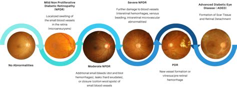 Kl Eye Specialist Centre Best Eye Specialist Kuala Lumpur