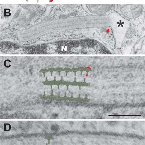 Perinuclear Space In Alveolar Type Ii Cells Often Showed Protein