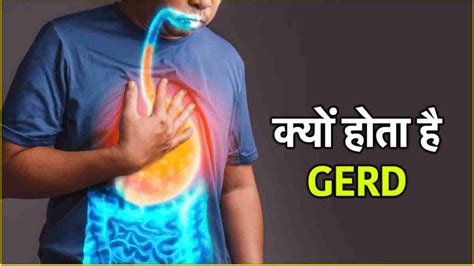 खाने के बाद बार बार डकार आना या पेट फूलना हो सकता है Gerd का संकेत Is Frequent Belching Or