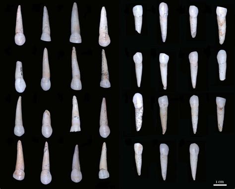 Development Of Teeth Enables Sex From Fossil Site To Be Estimated