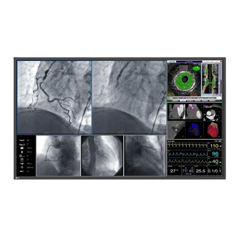 Eizo Curator Moniteurs Médicaux Radiologie And Cardiologie