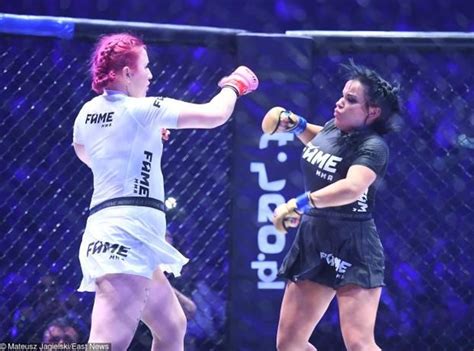 Dumna Marta Linkiewicz Pokazała Twarz Po Walce Z Sex Masterką Nigdy