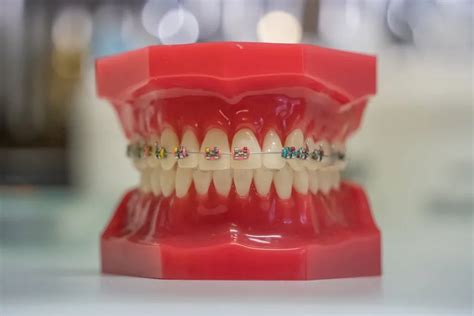 Brackets Cómo Funcionan Tipos Y Cuándo Usar