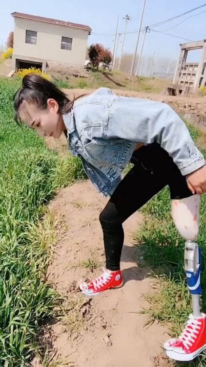 Chinese Amputee Girl With Prosthetic Leg And Red C Tumbex