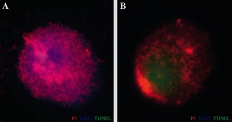 Protamine Levels Vary Between Individual Sperm Cells Of Infertile Human