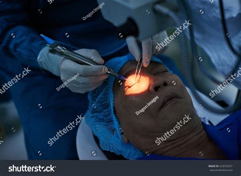 Images Cataract Surgery Instruments Photos And Images And Pictures