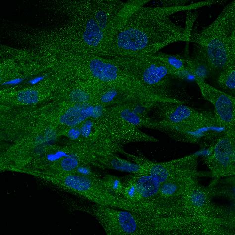 Cd90 Antibody 27178 1 Ap Proteintech