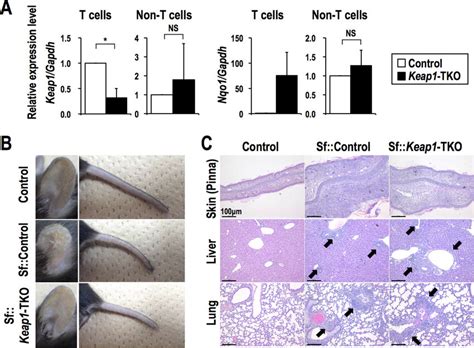 T Cell Specific Keap1 Deletion Alleviates Skin Inflammation A Gene