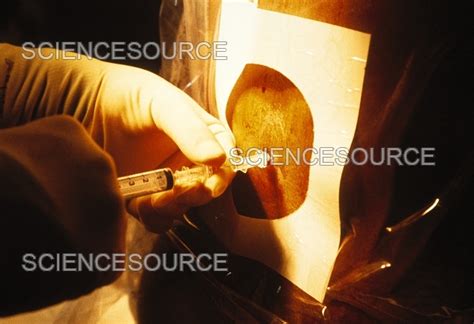 Epidural Anesthesia Stock Image Science Source Images