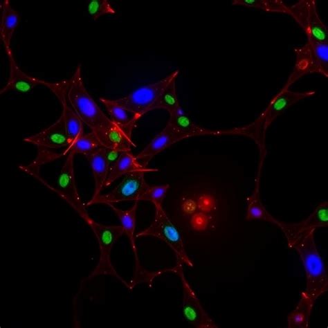 Il 17a Nkp44− Ilc3 Cells Build In Fap Duodenum