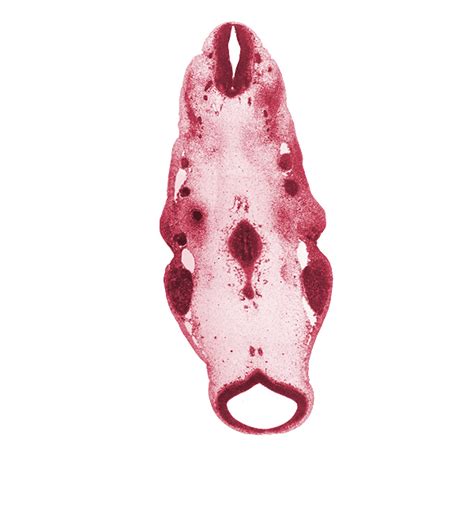 Cephalic Flexture Hacforless