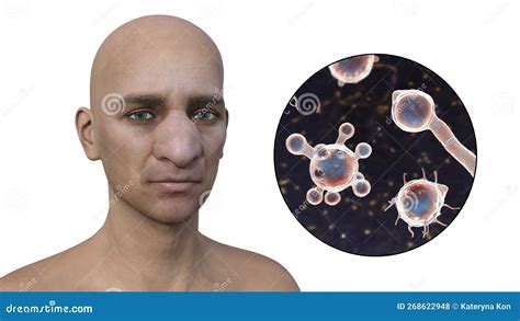 Conidiobolus Coronatus Microscopic Fungi 3d Illustration Tropical