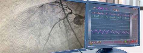 Fluoroscopia Cómo Y Para Qué Se Hace Blogs Mapfre