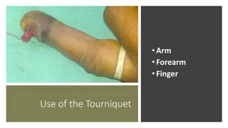 Perioperative Management Hand Surgery Nursing 2024 Pdf
