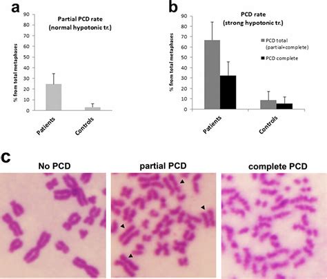 Analyses Of Centromere Cohesion In Mcph1 Patient Cells Metaphases