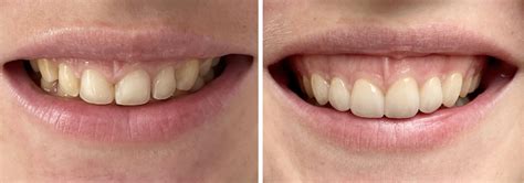 Duleba Digital Dental Lab