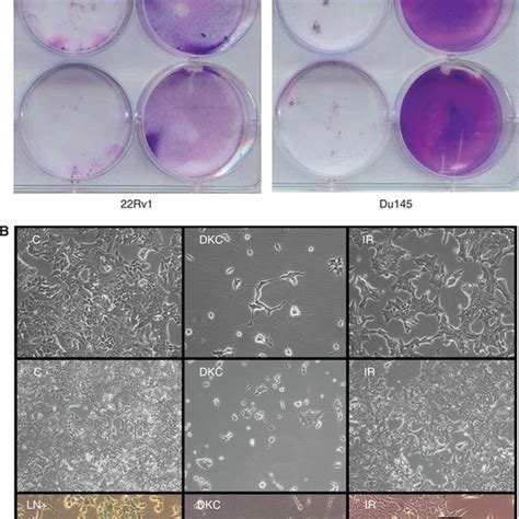 Expression Of Dkc1 In Prostate Cancer Cell Lines A Expression Of Download Scientific Diagram