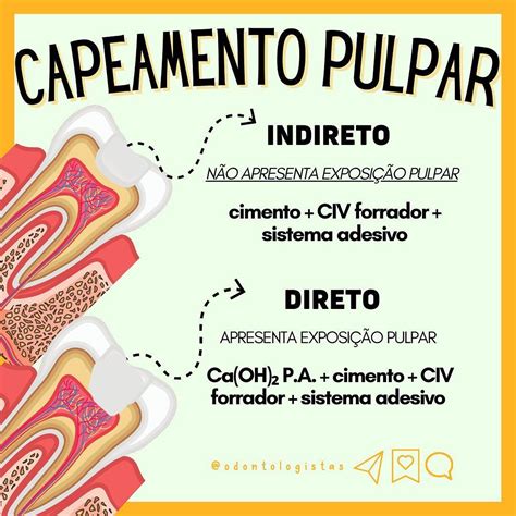 Capeamento Pulpar Direto Passo A Passo - LIBRAIN