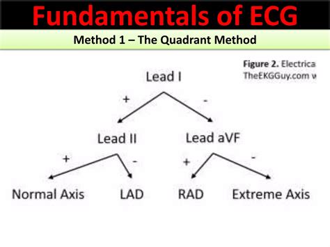Cardiac Axis Abnormalities In Ecg Pptx