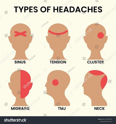 Types Headaches Illustration Vector Stock Vector Royalty Free 2078707855 Shutterstock