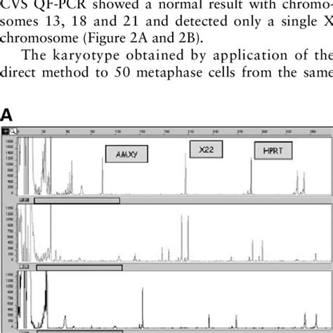markers at polymorphic sites for detection of the x chromosome