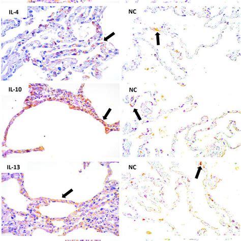 Positive Immunostaining Pattern For Ifn γ Il 4 Il 10 Il 13 And