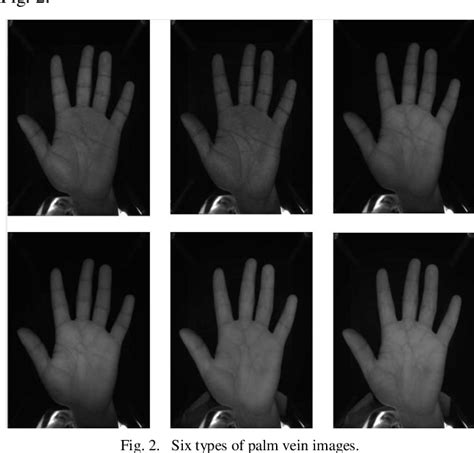 Figure 2 From Contactless Palm Vein Recognition System With Integrated Learning Approach System